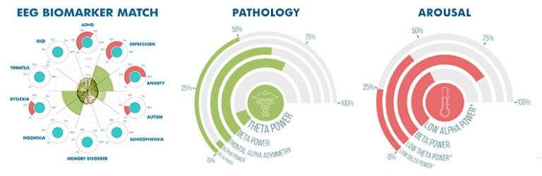 Brain Mapping: Understanding How Your Brain Works - Pivot Point Family ...